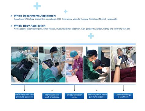 컬러 도플러 Wifi 선형 초음파 스캐너 4 12mhz Cdc 2