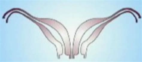Benign Conditions Of The Uterus Cervix Ovary And Fallopian Tubes