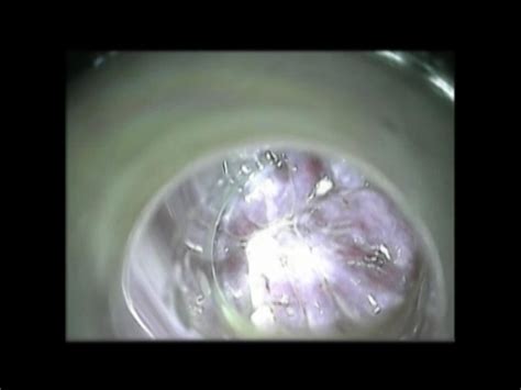 Obstetrics Gynecology