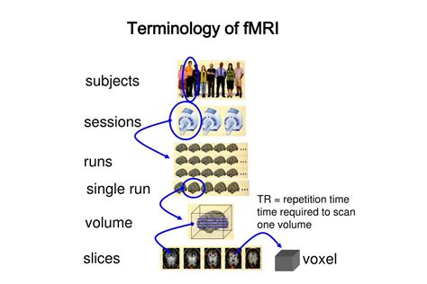 Ppt Spatial Preprocessing Of Fmri Data Powerpoint Presentation Free Download Id 2001962