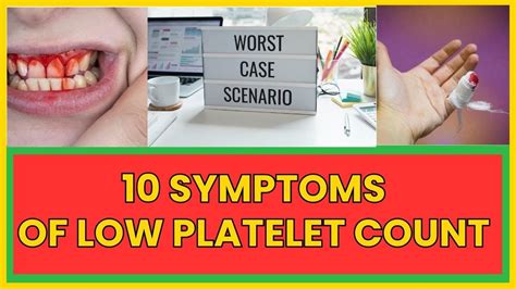 Symptoms Of Low Platelets Recognizing Signs Of Thrombocytopenia Youtube
