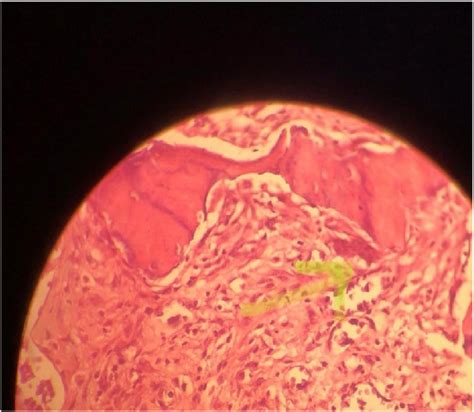 Osteoclast Cell × 400 Magnification Download Scientific Diagram