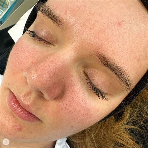 Visible Pores 6 Tips For Minimizing Large Pores With Makeup Loréal