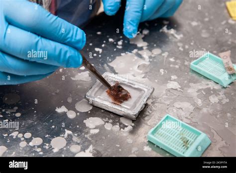 Scientist Embedding Tissues In Paraffin Blocks For Sectioning