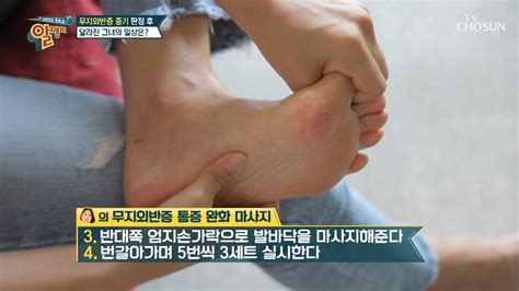 무지외반증 운동법·마사지 방법 공개 [알맹이] 81회 20200712 Youtube