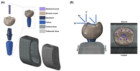 Three Dimensional Finite Element Analysis Of Stress Distribution In