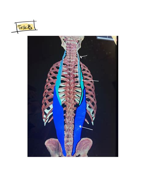 Knh 244l Spine Muscles Chm 141 Fa If A Semispinalis Capitus Semispinalis Cervicis