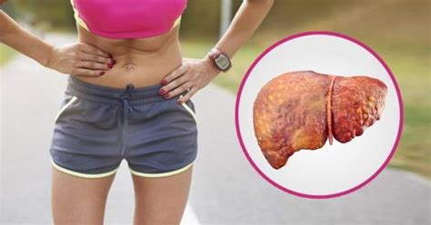 სამედიცინო ტესტი დაადგინეთ რამდენად ჯანმრთელია თქვენი ღვიძლი