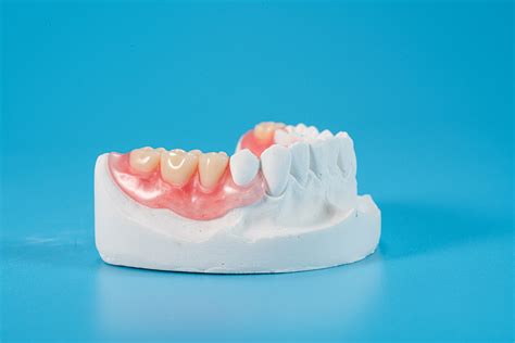 Detec Flexible Resin Partial Denture Base Detec