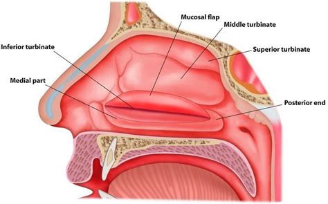 Turbinoplasty Otorhinolaryngology Ear Nose Throat