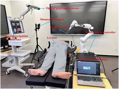 Medical Robot Navigation Board Solution Anypcba