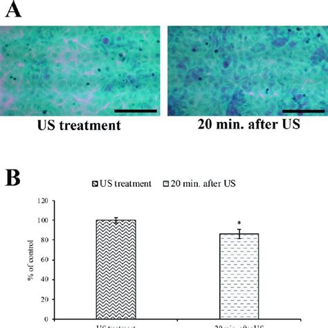 Restoration Of The Zo 1 Subcellular Localization In The Absence Of Us