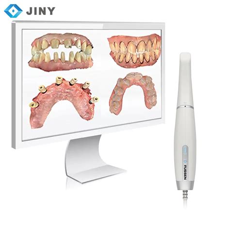 Portable Handheld Intraoral Oral Scanner Dental Digital Impression Intraoral Scanner Dental