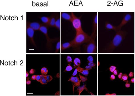 Figure 1 From Opposing Actions Of Endocannabinoids On Cholangiocarcinoma Growth Is Via The