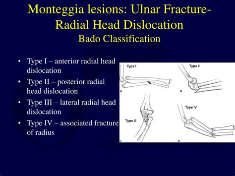 Ppt Fractures And Dislocations About The Elbow In The Pediatric