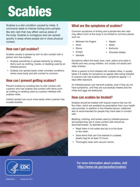 Scabies Fact Sheet Download Free Pdf Medical Specialties Diseases