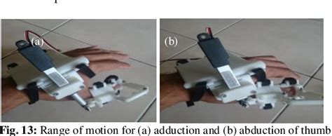 Figure 13 From Design Of Thumb Exoskeleton Rehabilitation Device Semantic Scholar