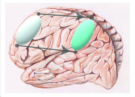 Reorganization Via A Sort Of Network Translation From Frontal Download Scientific Diagram