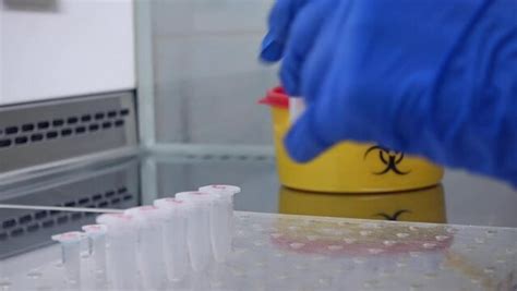 Eppendorf Images Parcourir 1 654 Le Catalogue De Photos Vecteurs Et Vidéos Adobe Stock