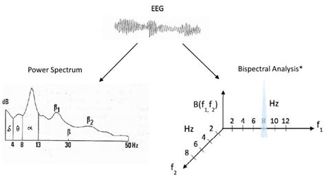 Bispectral Index Monitoring And Intraoperative Awareness Virtual Library