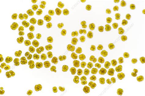Botryococcus Green Algae Micrograph Stock Image C029 3495
