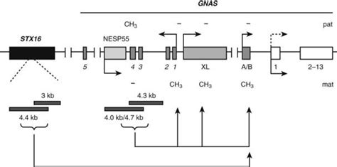 Pseudohypoparathyroidism Albrights Hereditary Osteodystrophy And Progressive Osseous