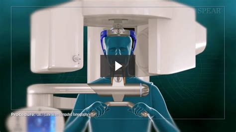 Cbct Cone Beam Computed Tomography Westney