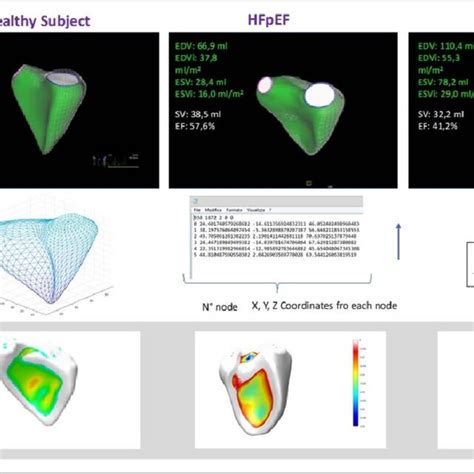 Three Dimensional Right Heart Echocardiography Reconstruction And Download Scientific Diagram
