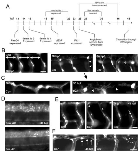 Ceramide Inhibits Angiogenesis In Zebrafish Embryos A Developmental