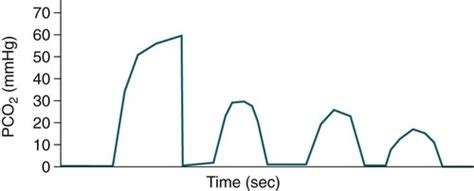 Monitoring Respiration—technology And Techniques Neupsy Key