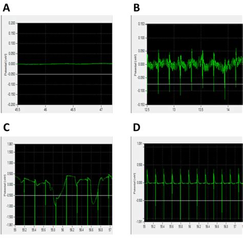 Microelectrode Array Recording Of Sinoatrial Node Firing Rate To Identify Intrinsic Cardiac