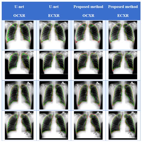 Mathematics Free Full Text Lung X Ray Segmentation Using Deep