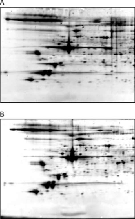 two dimensional gel electrophoresis of injected porcine biceps femoris download scientific