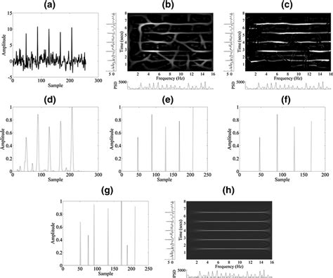A A Simulated Newborn Eeg Signal B The Adtfd Download Scientific