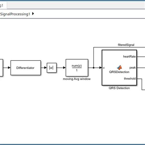 Detailed Ecg Signal Processing Block Download Scientific Diagram
