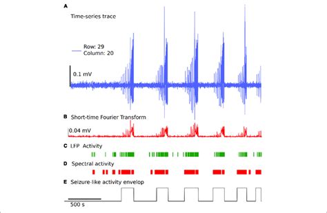 simple and fast unsupervised seizure detection method a the raw