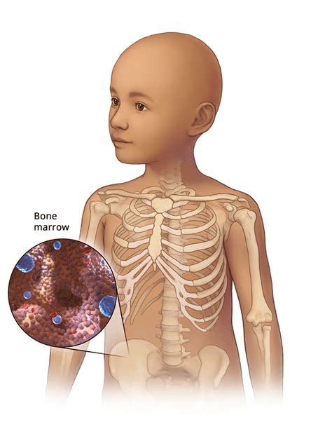 Cancer Types Of Cancer St Jude The Basics Of Blood