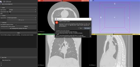 Error While Using Total Segmentator Support 3d Slicer Community
