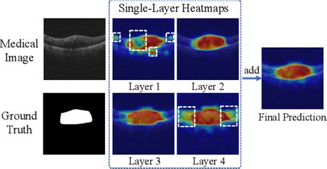 Figure From Adapting Visual Language Models For Generalizable Anomaly Detection In Medical