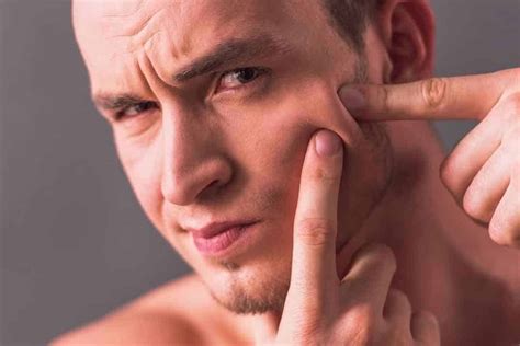 Ingrown Facial Hair 5 Fixes You Should Know Bald And Beards