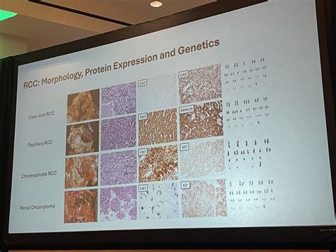 Neeraj Agarwal Excellent Talk By Michelle Hirsch On The Pathology