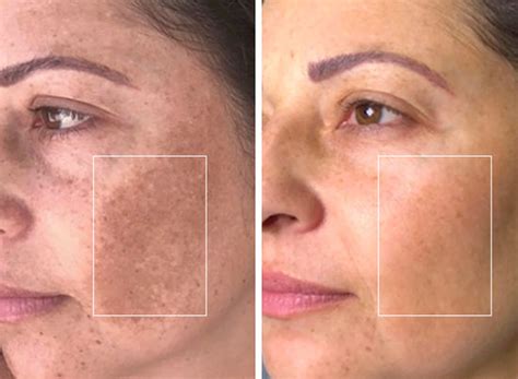 Complexion Code Plus Surplexion Complexion Code Plus Surplexion