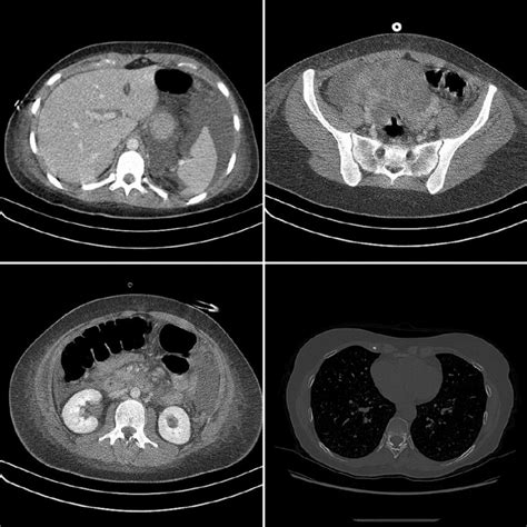 Four Example Images Of The Dataset Used For Error Measurement Download Scientific Diagram