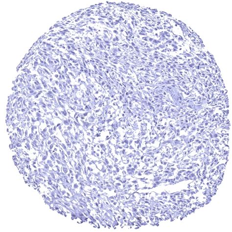 Cancer Tissue Gallery Gtx04380 Genetex