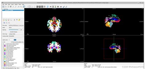Pytorch~mri脑扫描图像分割mri数据集医学影像分割python Csdn博客