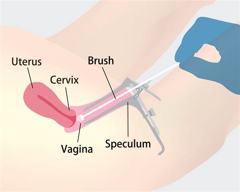Cervical Screening Programme Cervical Screening
