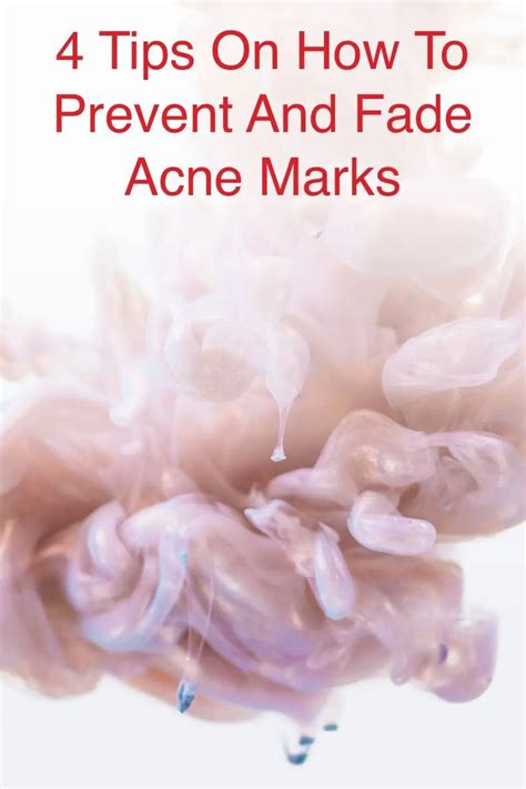 Since We Know How A Pimple Mark Appears The Best Way To Fade It Is Prevention Fade Acne Marks