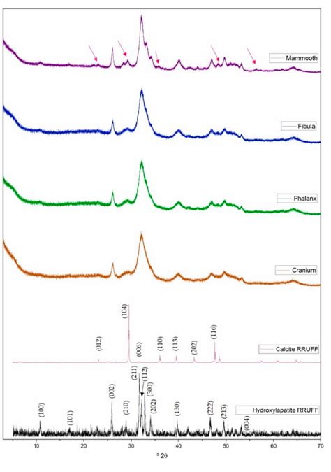 xrd patterns of bone samples and reference patterns of hydroxyapatite