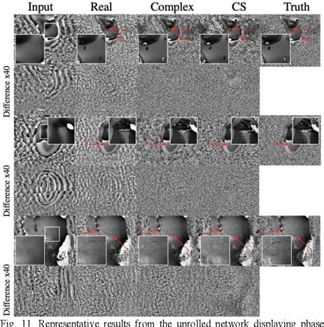 Figure 11 From Complex Valued Convolutional Neural Networks For Mri Reconstruction Semantic