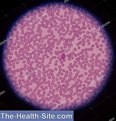Eritrocitos Lo Que Significa El Valor De Laboratorio 💊 Científico